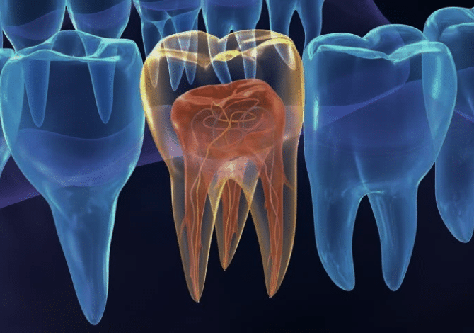 What Is a Root Canal? | Root Canal Therapy in Schaumburg, IL