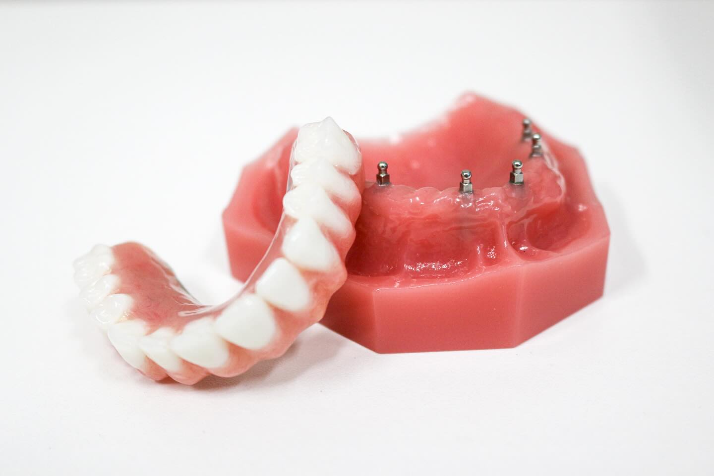 Dental Implant Denture in Schaumburg, IL | Free Consultations
